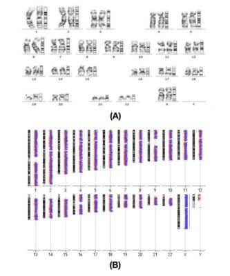 Comparison Between Karyotyping and Microarray – KaryotypingHub