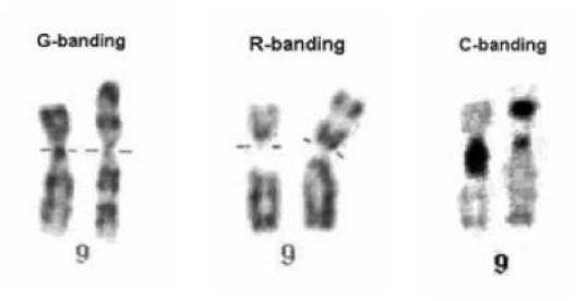 What is R banding?- Principle, Requirements, Process, Protocol and ...