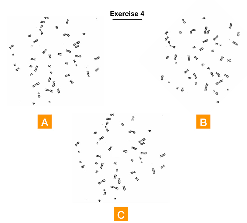 10 best karyotyping activities and assignments – KaryotypingHub